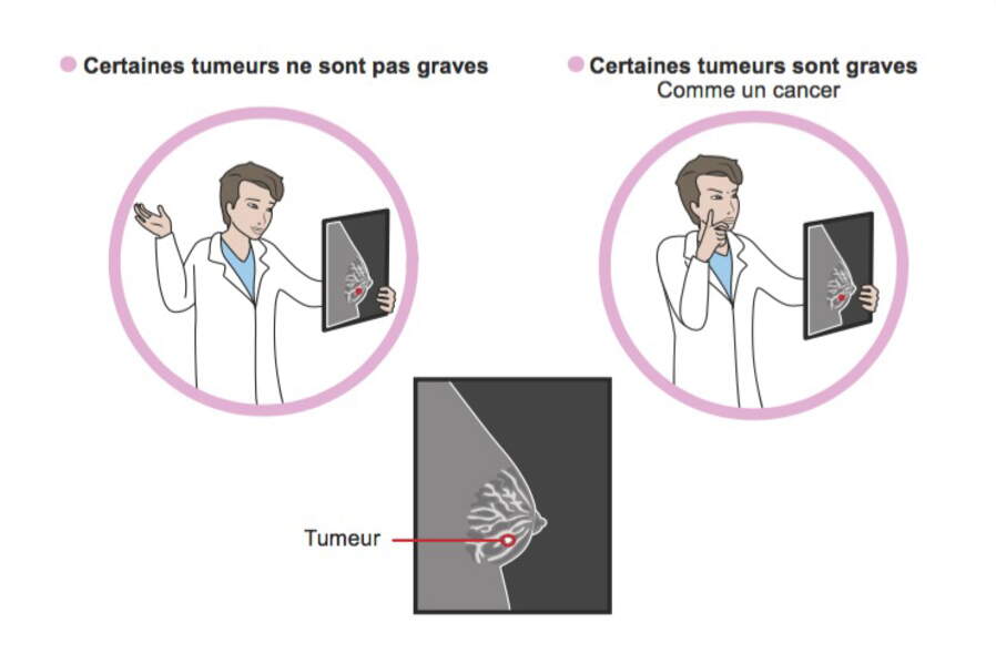 Mammographie : comment se passe l’examen, étape par étape - Femme Actuelle