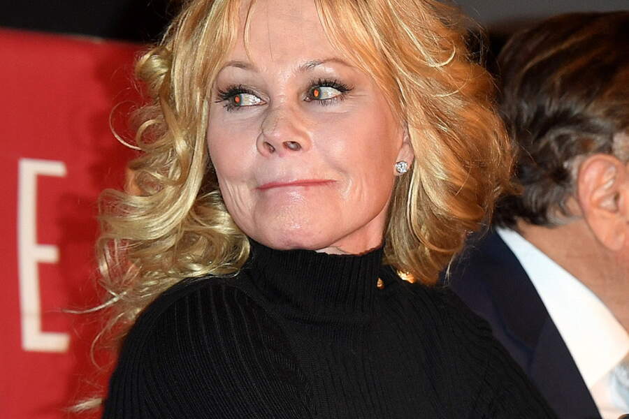 Melanie Griffith, courageuse, assume son visage transformé par un ...