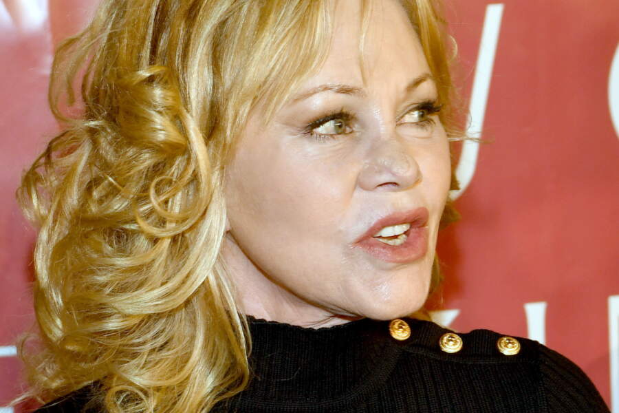 Melanie Griffith, courageuse, assume son visage transformé par un ...