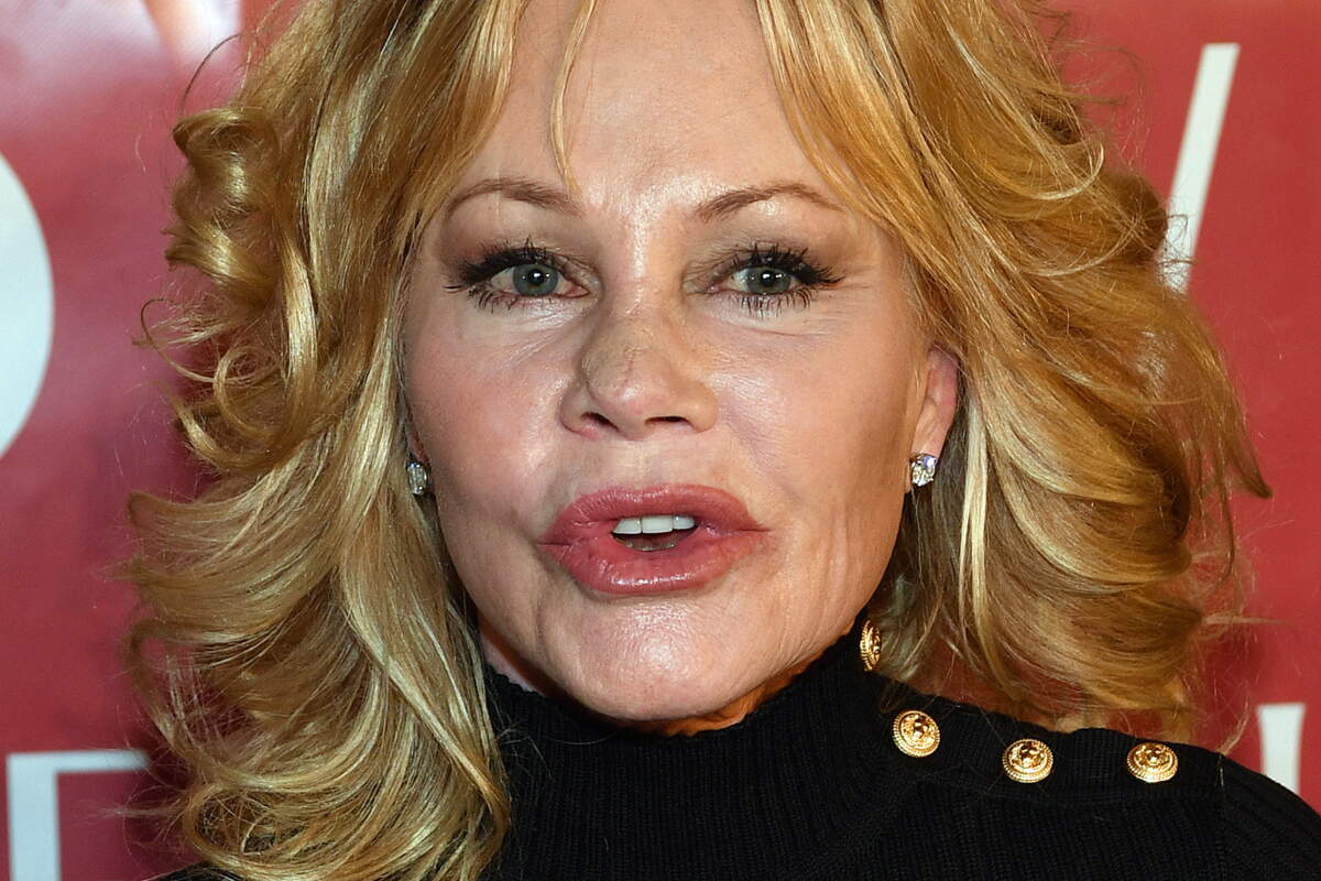 Melanie Griffith, courageuse, assume son visage transformé par un ...