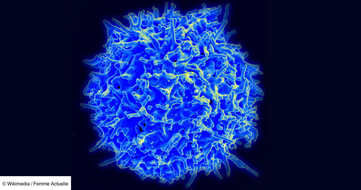 Leucémie : un nouveau traitement miracle ? : Femme Actuelle Le MAG