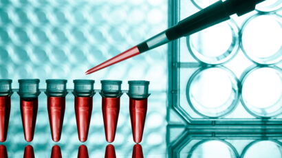 Test de Schamroth : ce geste simple à faire avec vos doigts peut ...