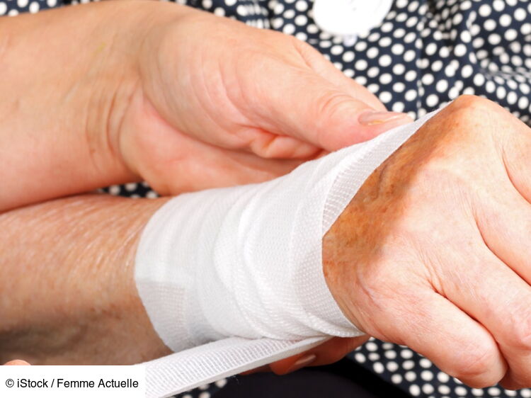 Premiers secours : comment réagir face à une brûlure ? : Femme Actuelle ...