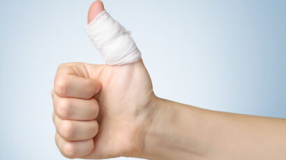 Panaris : une infection à soigner rapidement - Un traitement rapide ...