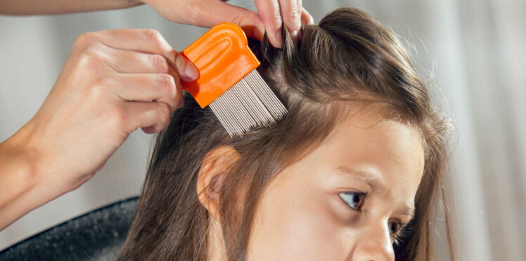 Poux, lentes : les conseils du spécialiste pour en venir à bout : Femme ...