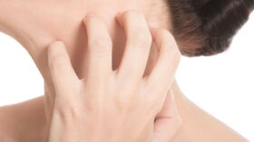 Tout savoir sur la maladie de Verneuil : Femme Actuelle Le MAG