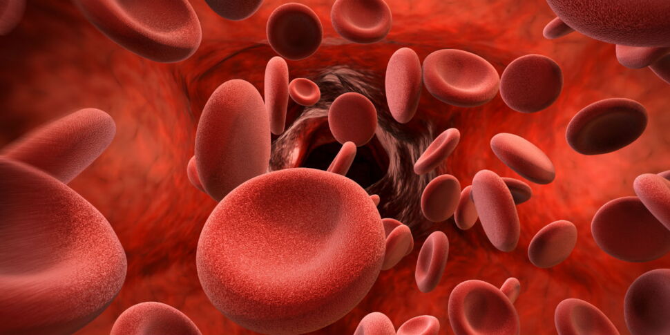 Drépanocytose : un patient a été guéri de cette maladie génétique ...