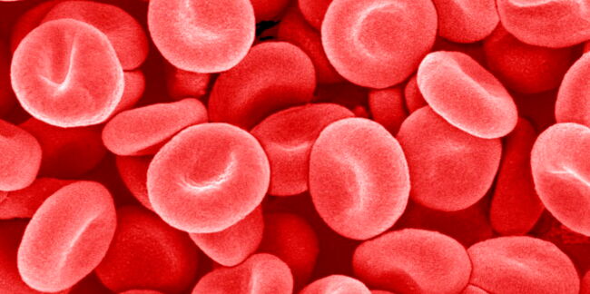 Soutenez la lutte contre la drépanocytose : Femme Actuelle Le MAG