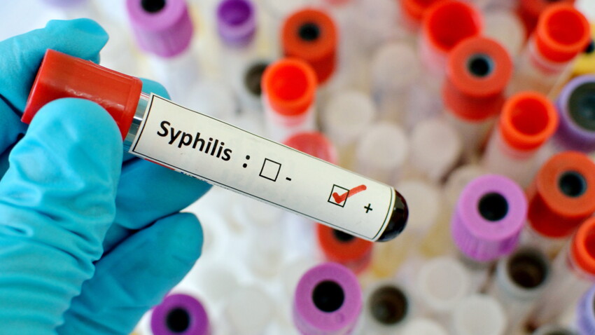 Syphilis : 400 à 500 nouveaux cas en France chaque année : Femme ...
