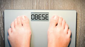 Surpoids : un tiers de la population mondiale concerné : Femme Actuelle ...