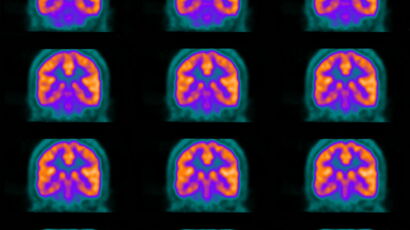 Scanner, IRM, échographie... Tout savoir sur l'imagerie médicale ...