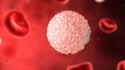 Septicémie : quels sont les symptômes de cette infection bactérienne ...