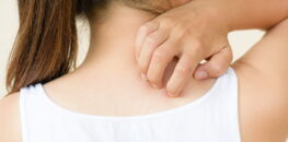 Symptômes, traitements : 5 trucs à savoir sur le zona : Femme Actuelle ...