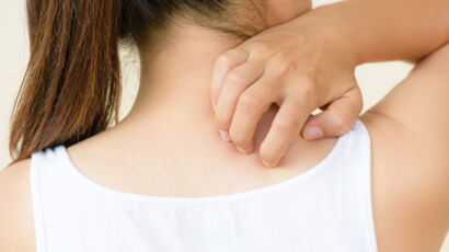 Zona : symptômes, traitement et prévention : Femme Actuelle Le MAG