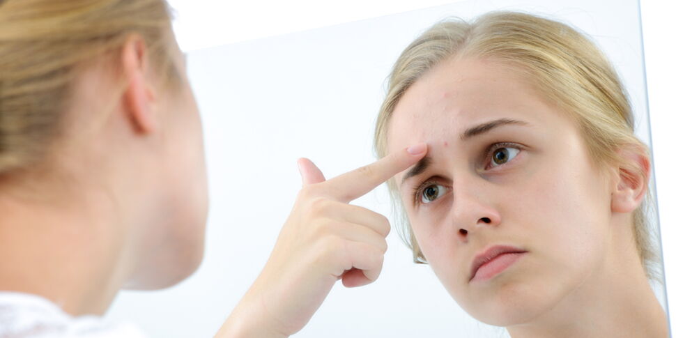 Mon ado a de l’acné : 5 pistes pour l’aider à vivre avec : Femme ...