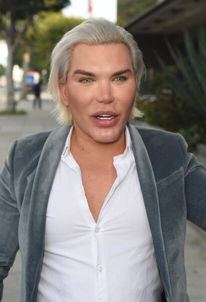 Rodrigo Alves, surnommé le “Ken humain” : son évolution en images ...