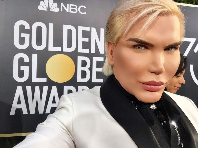 Rodrigo Alves, surnommé le “Ken humain” : son évolution en images ...