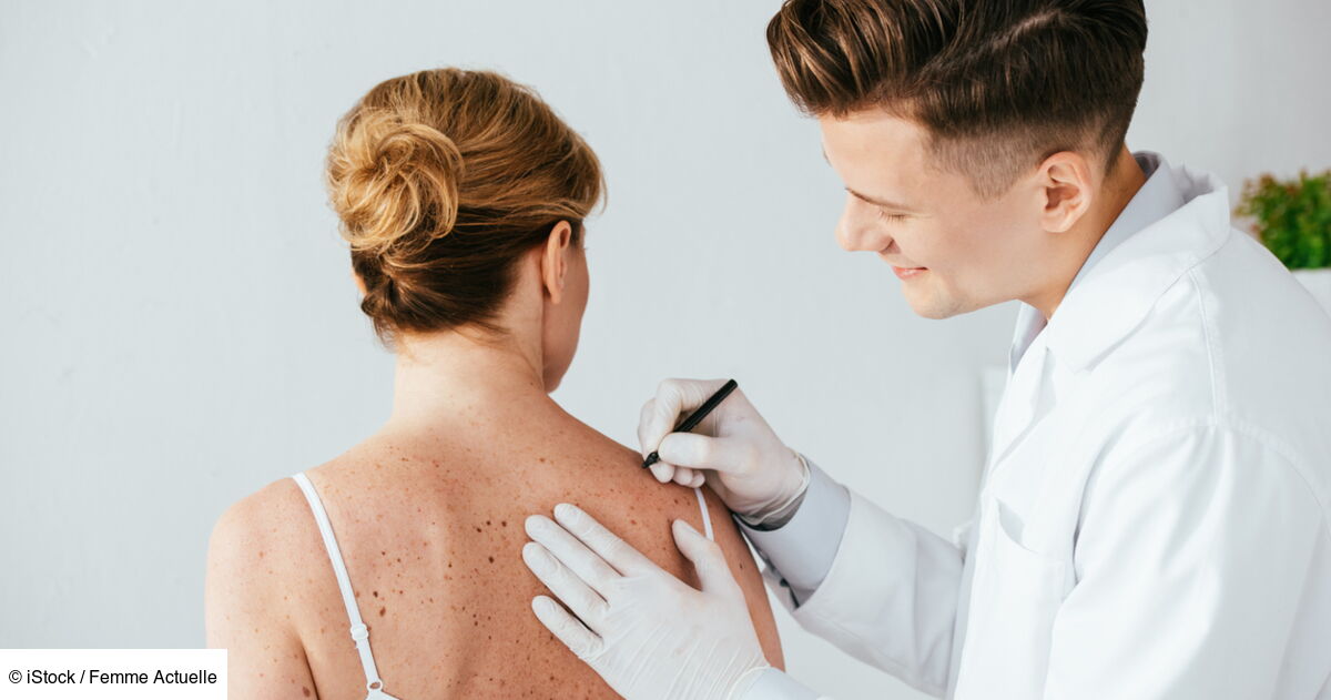 Grain de beauté qui gratte ou saigne : qu'est-ce que ça signifie et ...