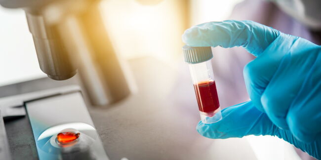 Anisocytose : comment expliquer cette anomalie sanguine et quand s ...