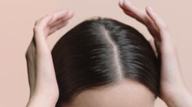 La teigne : soigner et prévenir cette infection du cuir chevelu : Femme ...