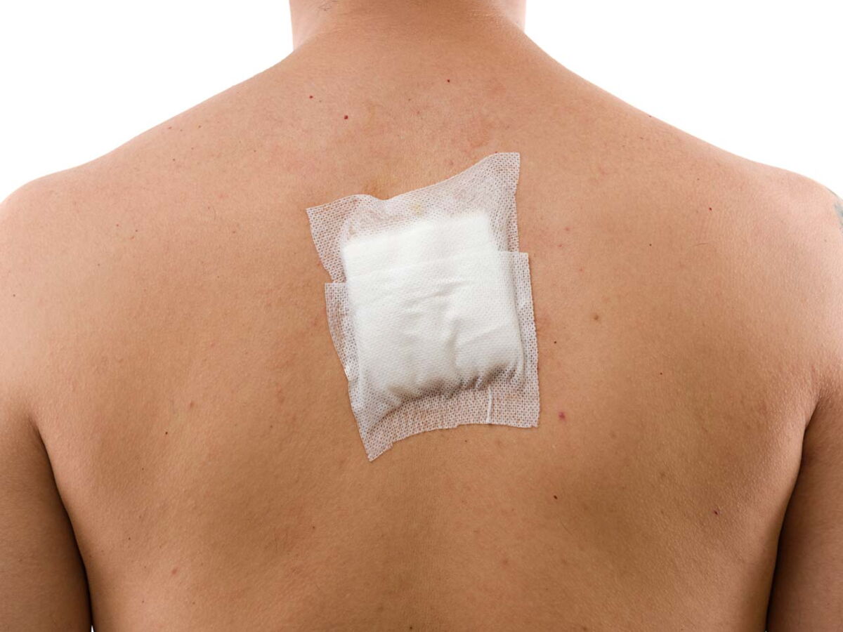 Furoncle Traitement Maison | Ventana Blog