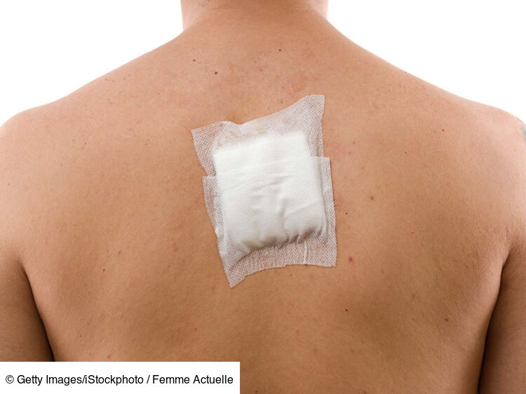 2 solutions contre le furoncle : Femme Actuelle Le MAG