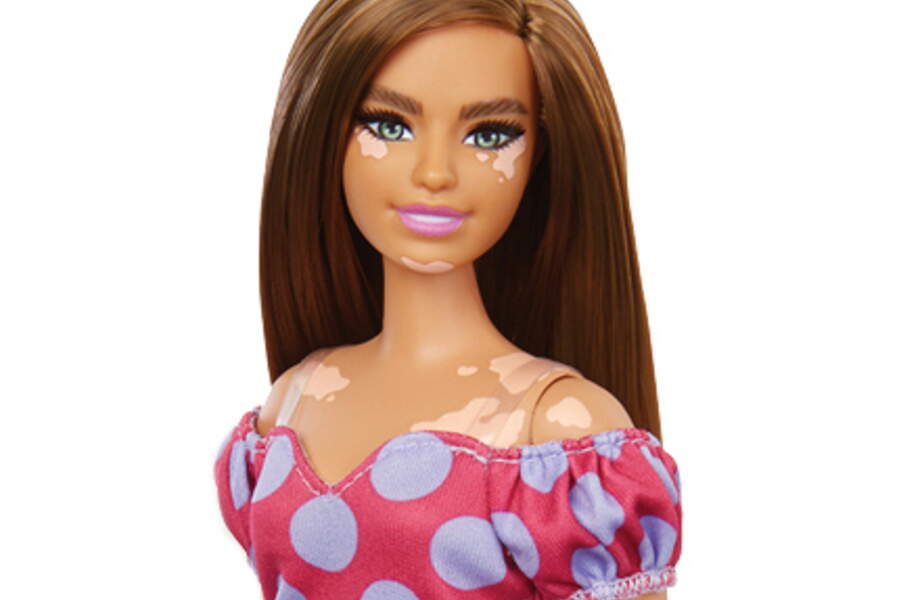 Handicap, vitiligo : les nouvelles poupées Barbie célèbrent la ...