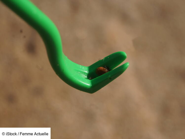 Piqûre de tique : comment utiliser un tire-tique ? : Femme Actuelle Le MAG