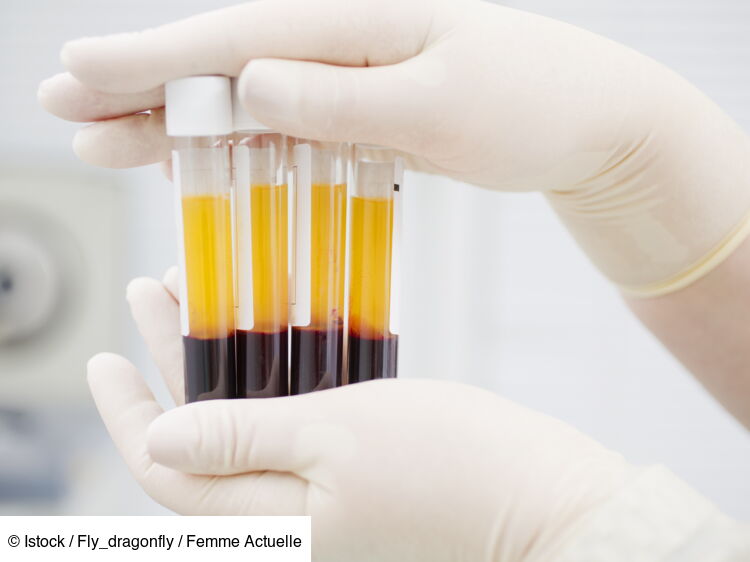 Thrombopénie : causes, symptômes, traitements, risques : Femme Actuelle ...