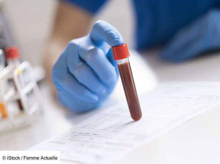 Numération formule sanguine (NFS) : comment interpréter cette analyse ...