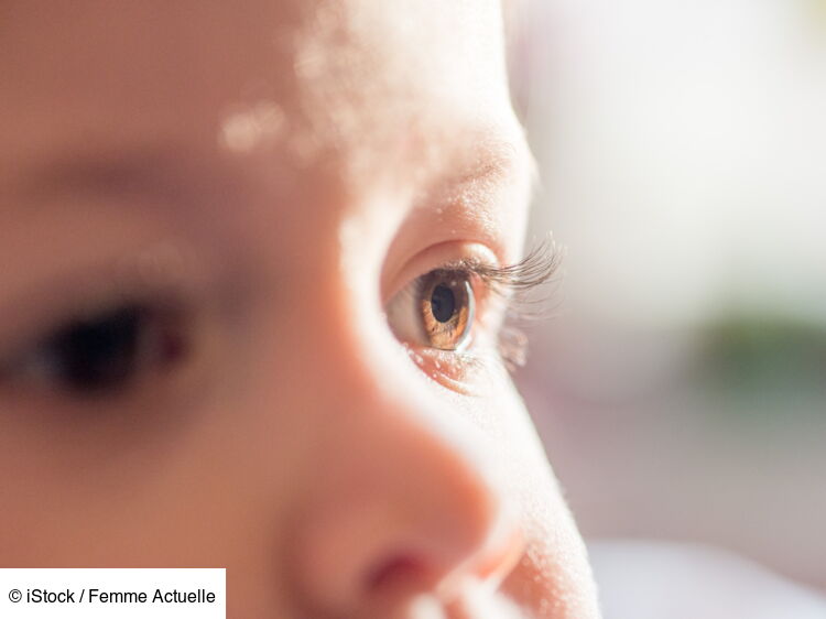 Conjonctivite de bébé : quels sont les symptômes et comment la soigner ...