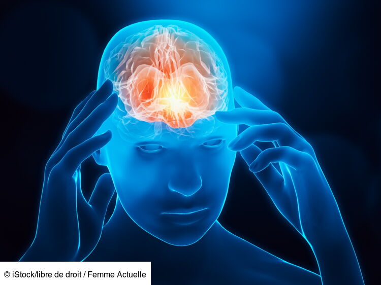 AVC (Accident vasculaire cérébral) : symptômes, causes, traitements et ...