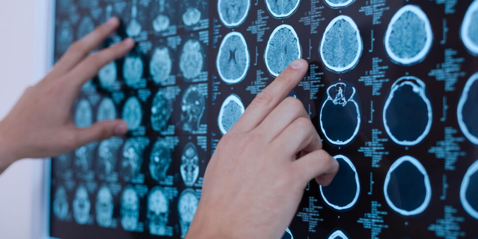 Ataxie : symptômes, traitements et espérance de vie : Femme Actuelle Le MAG