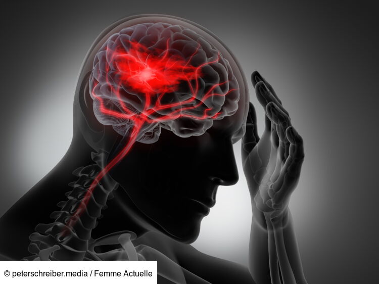 Bulbe rachidien : pathologies, examens et traitements : Femme Actuelle ...