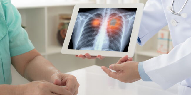 Scanner thoracique : intérêt, déroulement et prise en charge de l ...