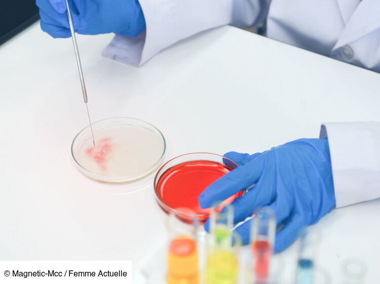 Staphylocoque : définition, contagion, symptômes et traitements : Femme ...