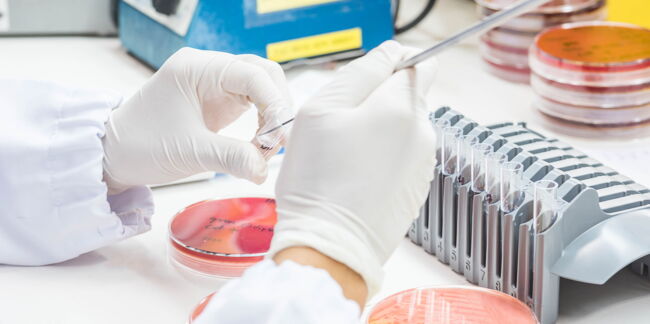 Septicémie : définition, symptômes, complications, traitements : Femme ...