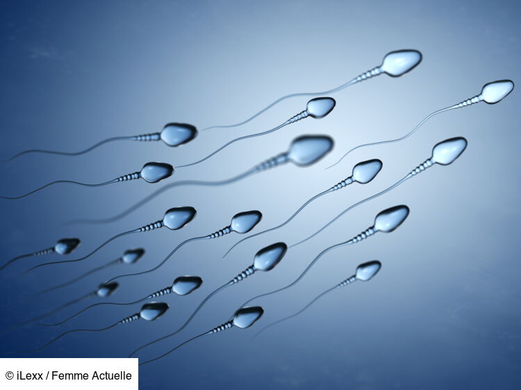 Spermocytogramme : utilité, déroulement et lecture des résultats ...