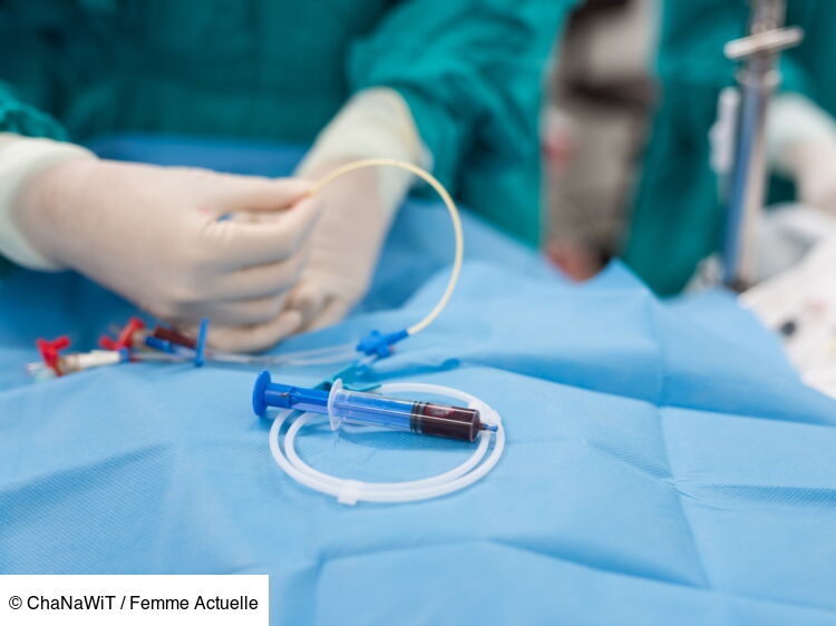 Cystocath urinaire : définition, utilité, pose et complications : Femme ...