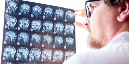 Hyperprolactinémie : causes, symptômes, conséquences, traitements ...