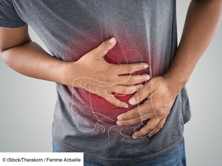 Rectocolite hémorragique : causes, symptômes, espérance de vie : Femme ...