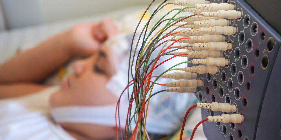 Électrochoc : définition, utilité et convalescence : Femme Actuelle Le MAG