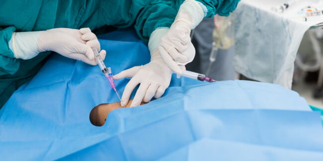 Ponction : définition, causes et déroulement : Femme Actuelle Le MAG