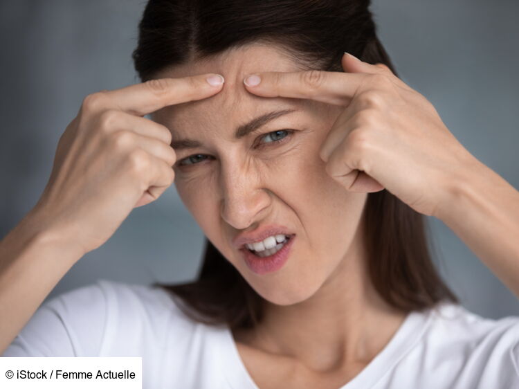 Points noirs : les meilleurs soins pour les éliminer efficacement ...