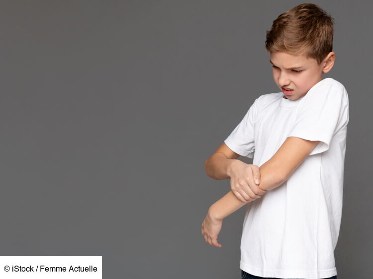 Arthrite juvénile : causes, symptômes, diagnostic, traitements : Femme ...