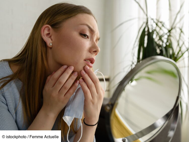 Boutons sur le visage : 7 astuces pour s'en débarrasser : Femme ...