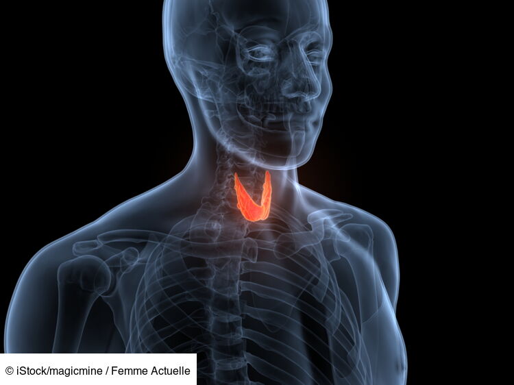Thyroïdite de Hashimoto : causes, symptômes, complications, traitement ...