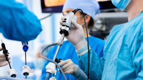 Appendicectomie : déroulement, complications possibles, cicatrice après ...