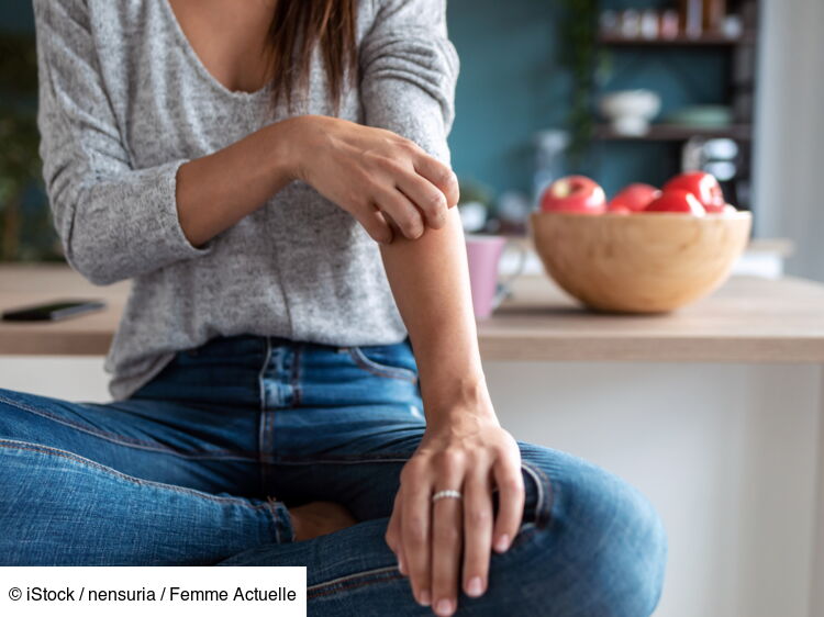Gale : comment bien reconnaître les boutons de cette maladie de peau ...