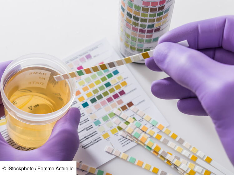 Diabète : comment bien utiliser les bandelettes urinaires ? : Femme ...